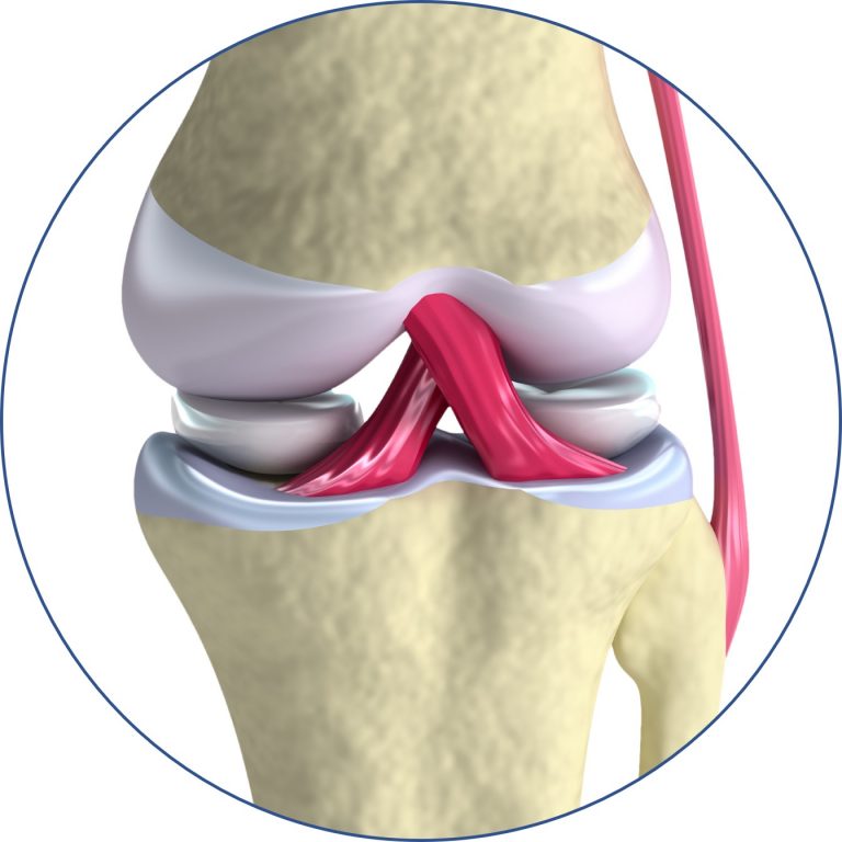 Lesiones de la rodilla